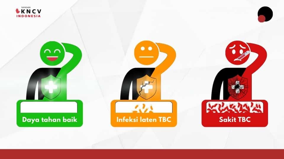 TPT (Terapi Pencegahan Tuberkulosis) | Yayasan KNCV Indonesia