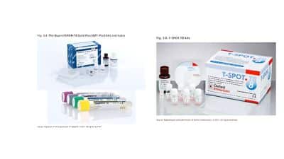 TPT (Terapi Pencegahan Tuberkulosis) | Yayasan KNCV Indonesia