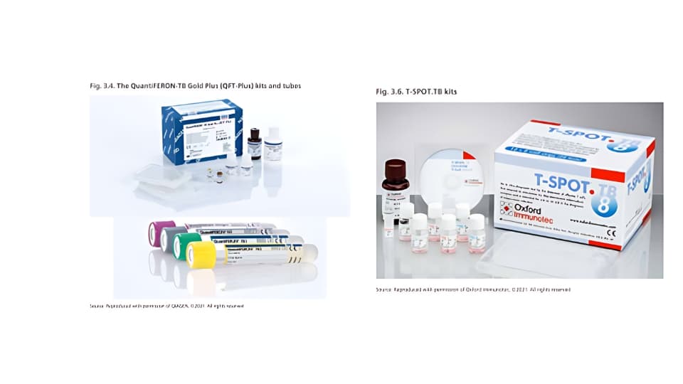 TPT (Terapi Pencegahan Tuberkulosis) | Yayasan KNCV Indonesia